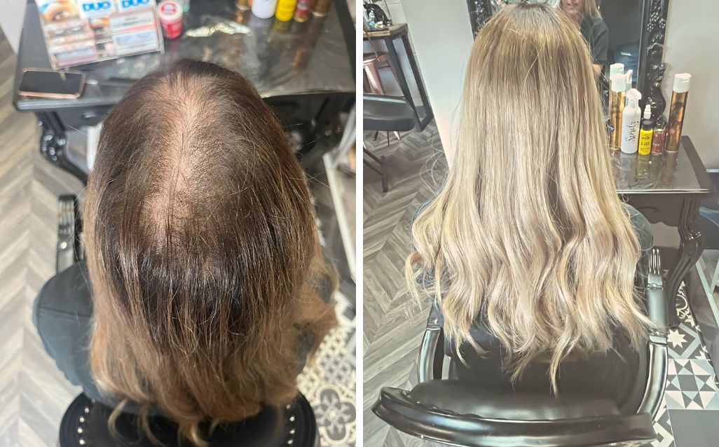 Le migliori extension per capelli per la calvizie e come applicarle